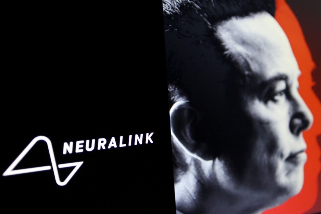 Neuralink : Elon Musk assure que son nouvel implant va rendre la vue ...